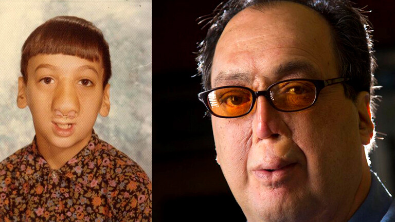 Howard Shulman: Waise ohne Gesicht · Dlf Nova