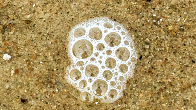 Medizin: Die Speichelspur führt zur Krankheit · Dlf Nova