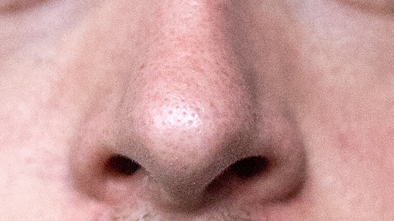 Evolution: Die Nase wird schwächer · Dlf Nova